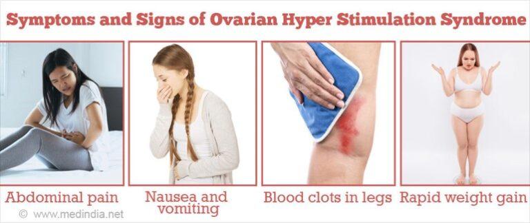 Ovarian Hyperstimulation Syndrome - Kanaa - Turning Dreams Into Families